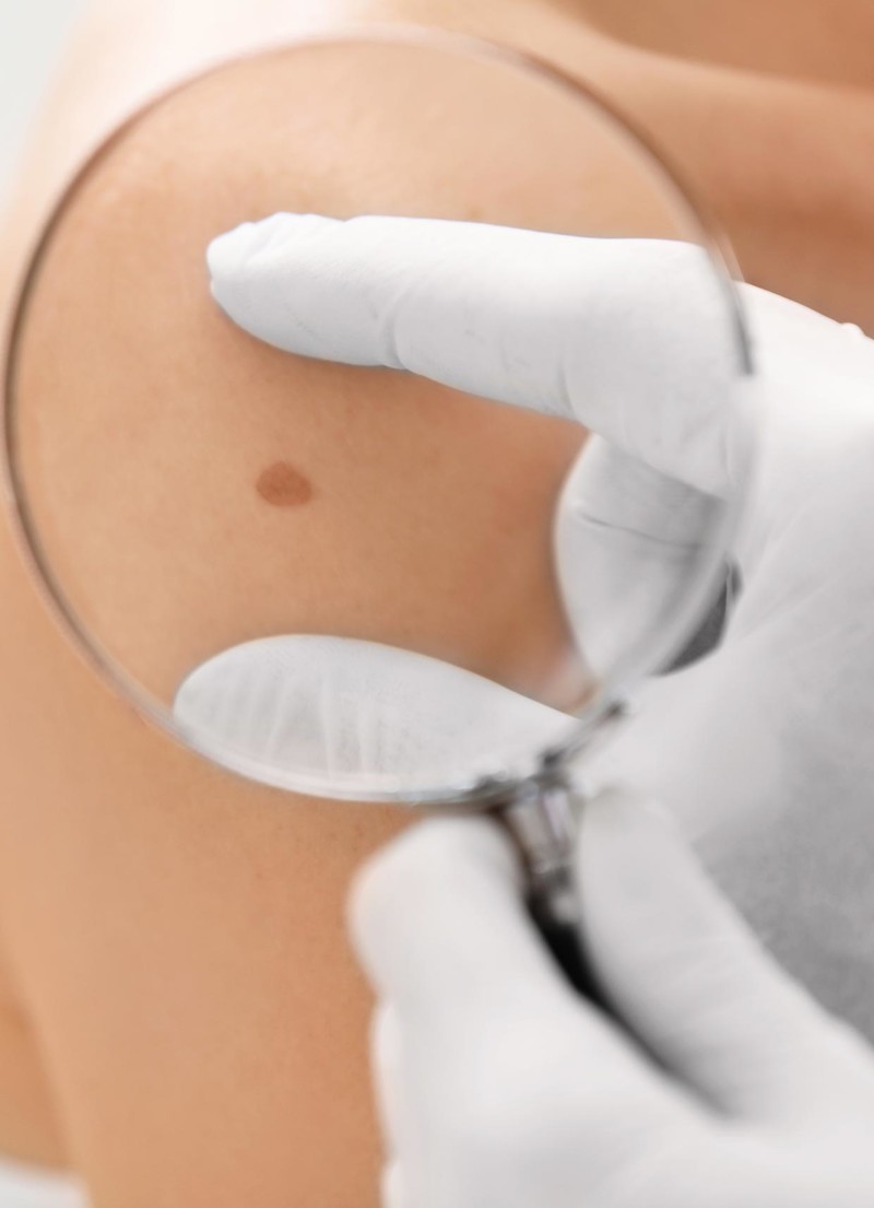 Biopsien - ono estetika - Ästhetische Medizin und Chirurgie